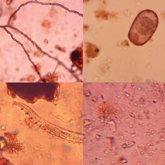 Urban Worm Interview Series: Soil Biology 101, Part II